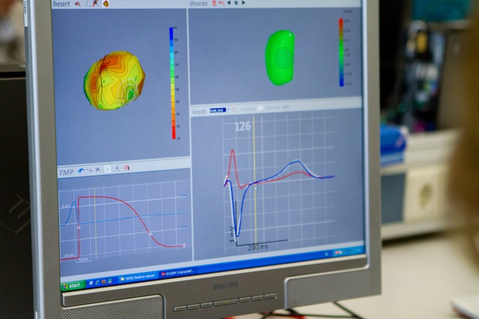 ECGSIM Downloads: Cases